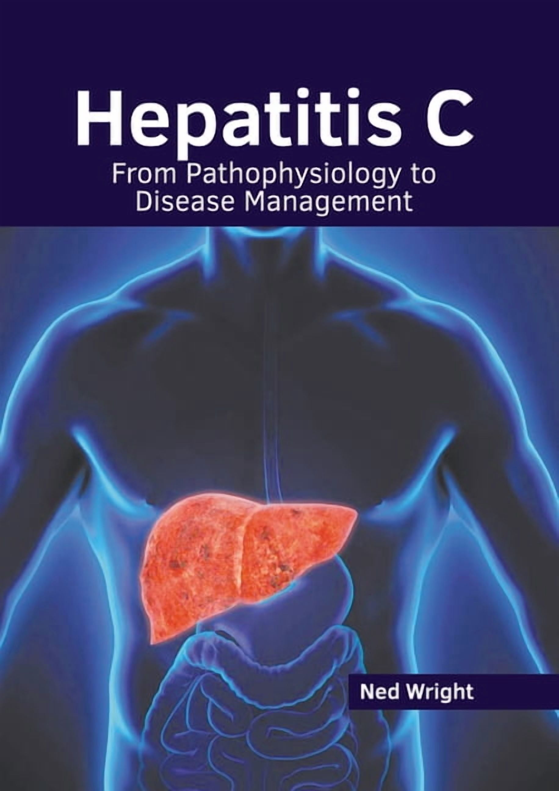 Hepatitis C: From Pathophysiology to Disease Management, (Hardcover ...