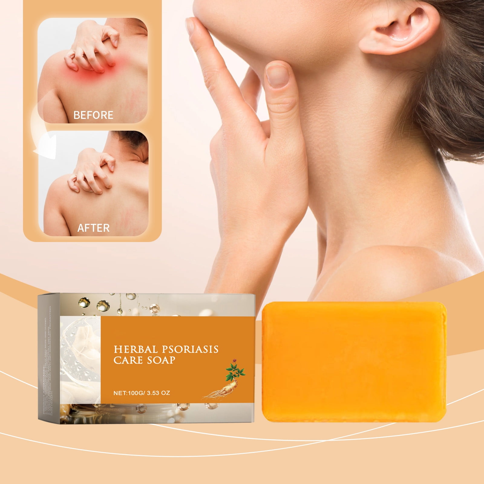 Herbal Psoriasis Care Soap,Psoriasis Herbal Soap,Psoriasis Removing ...