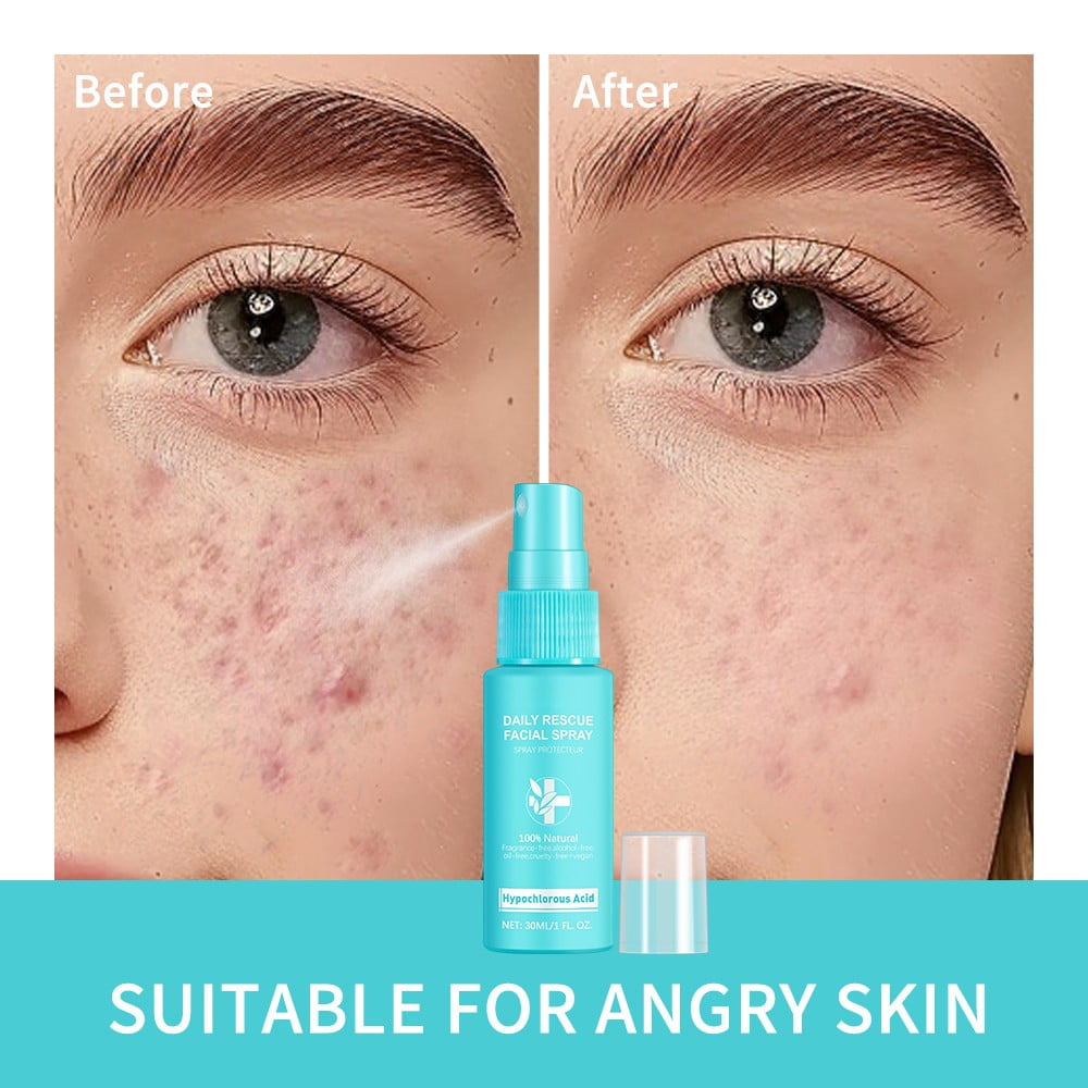 Herbzj Face and Skin Spray, Daily Rescue Facial Spray,Purify and Renew ...