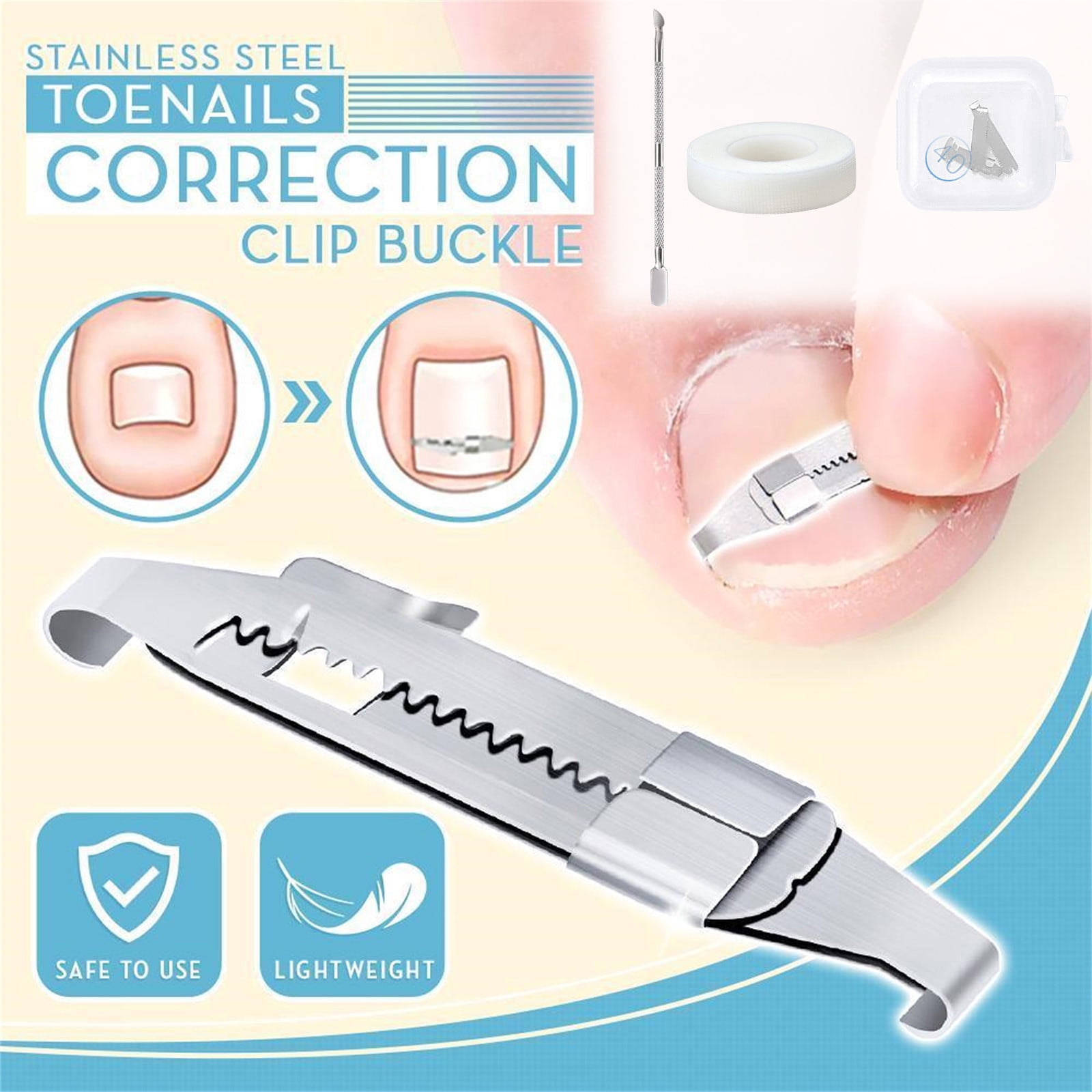 Herrnalise Ingrown Toenail Straightening Clip Stainless Steel Toenail ...