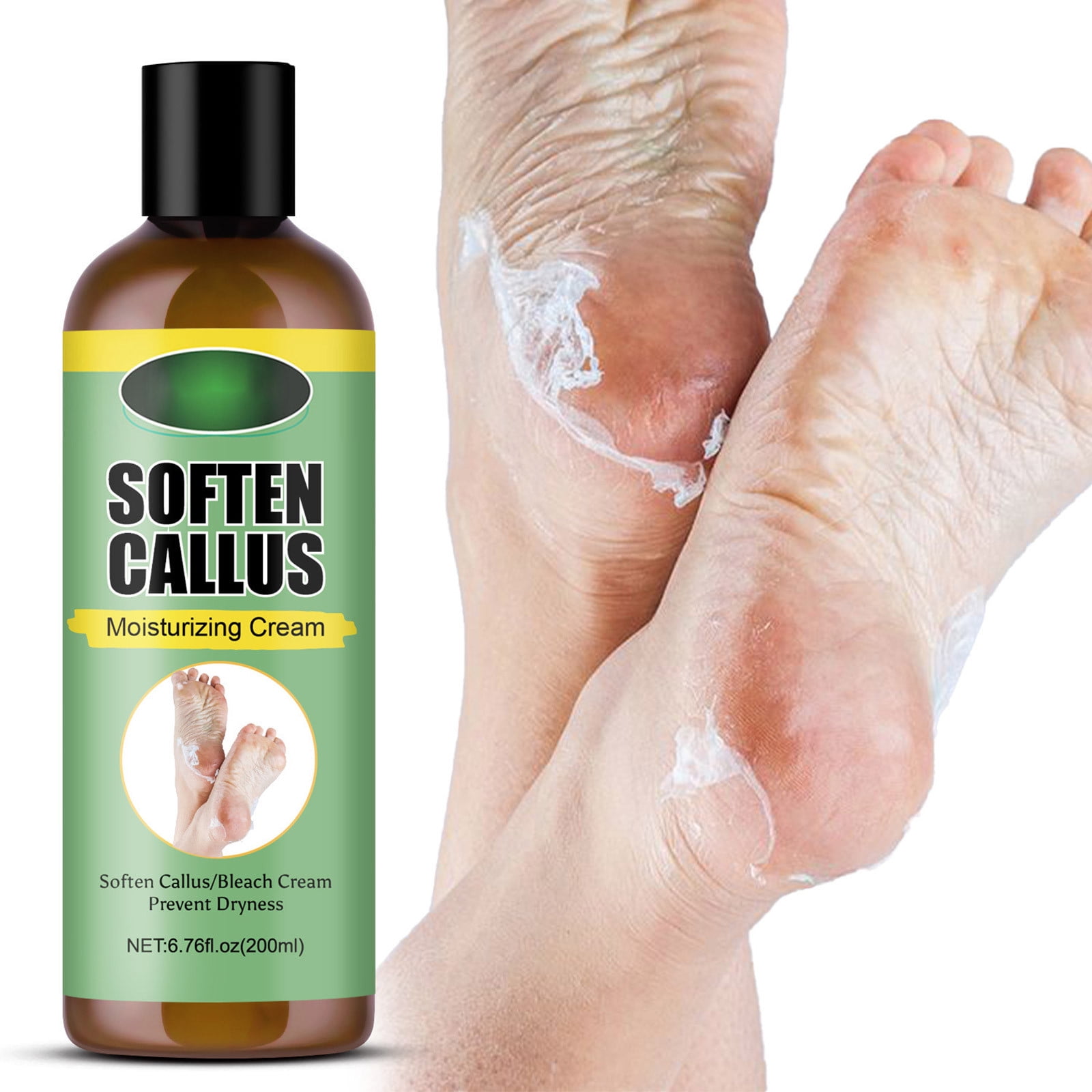 Herunwer Callus Remover Gel for Feet , Powerful Formulation Foot Callus ...