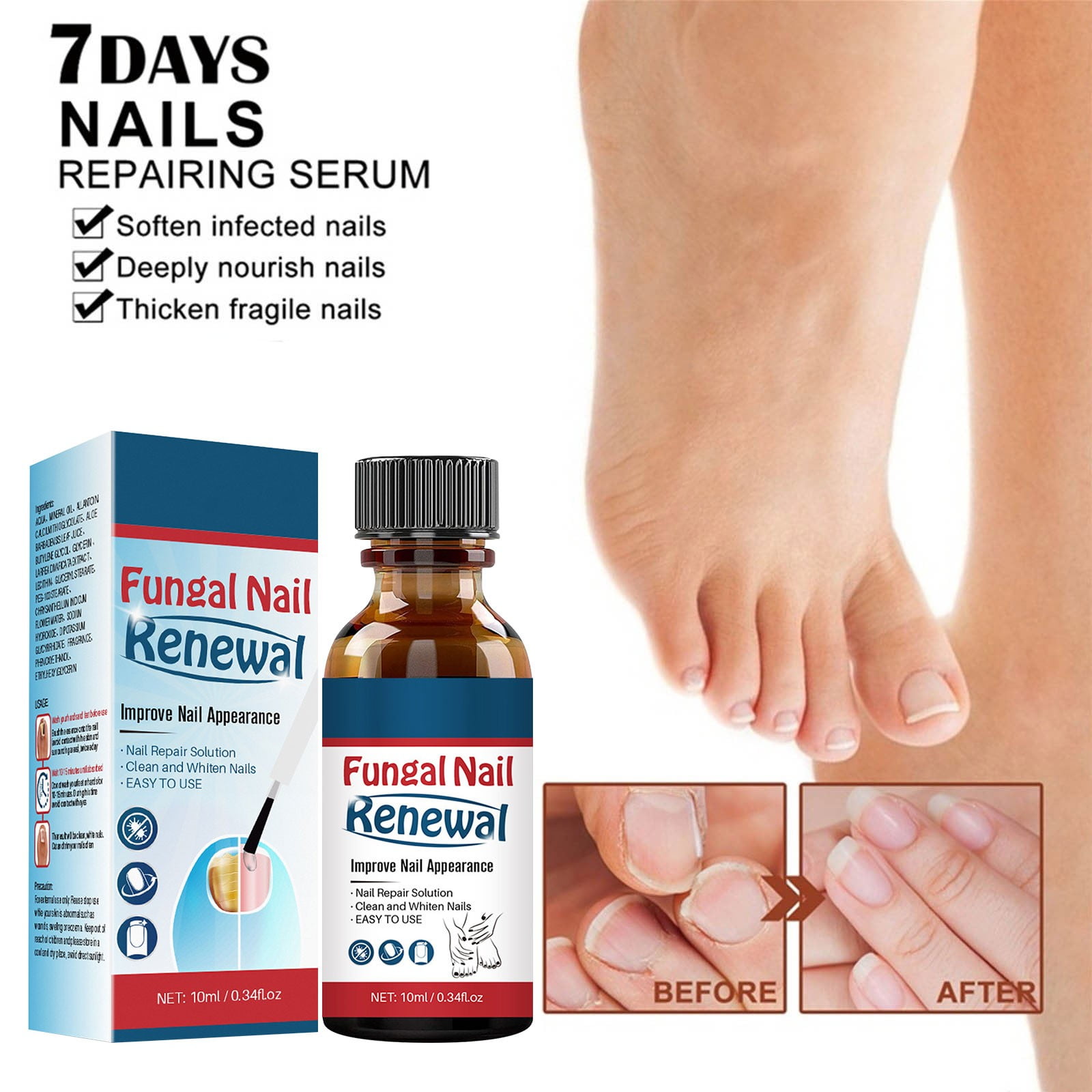 Hgferr Skin Care,Nail Toenail Extra Strong Nail Repair Set Fingernail ...