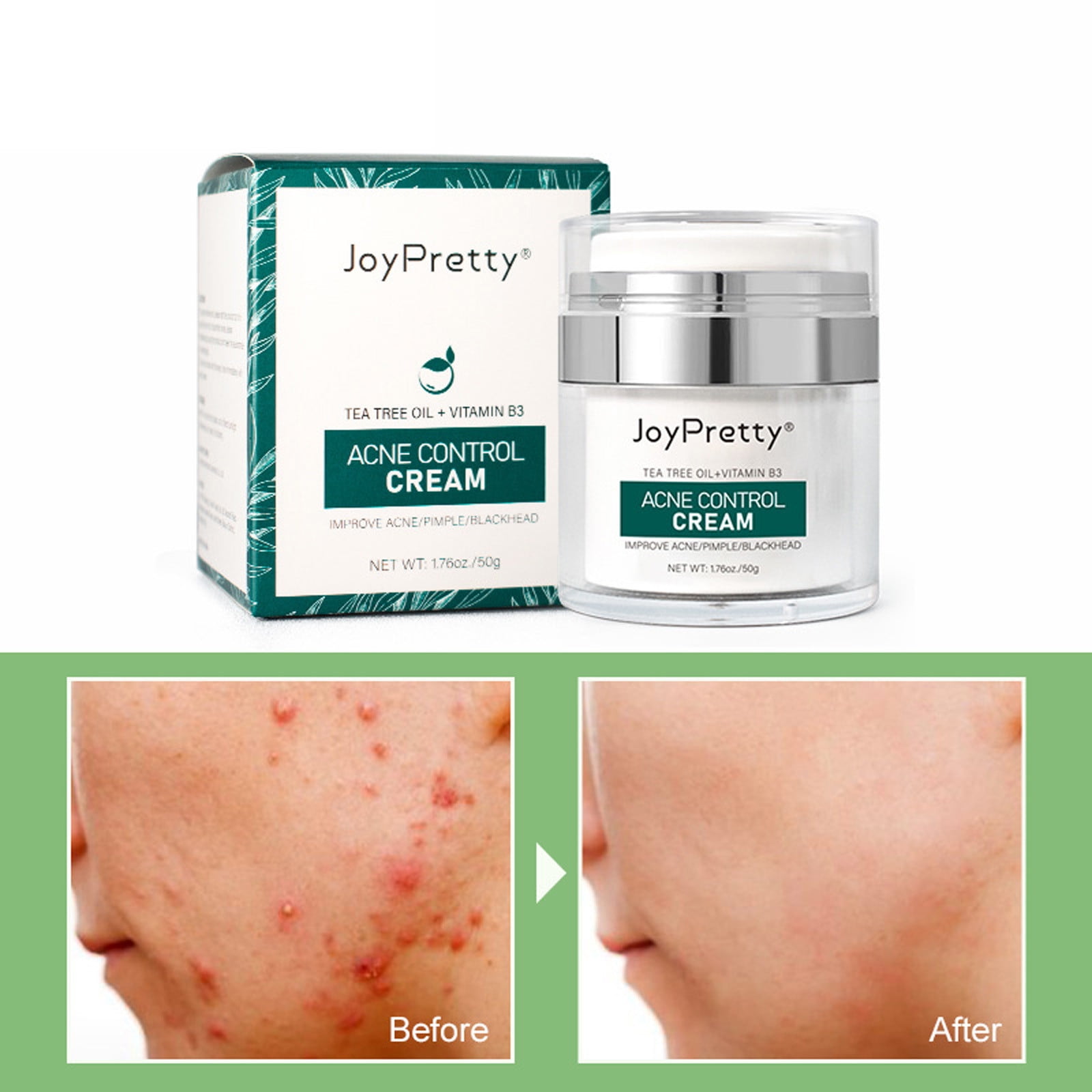 Hgferr Skin Care, Removal Ointment And Cream Mark And Removal Cream ...