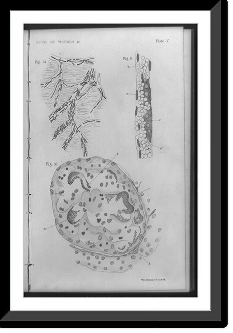 Historic Framed Print, [Bacteria found in wounds as drawn from a ...
