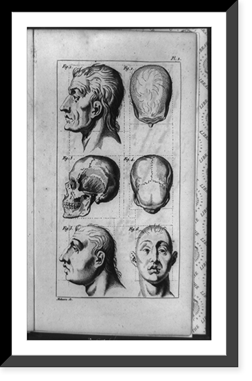 Historic Framed Print, [Cranial shape of skull of sane man in figure 3 ...