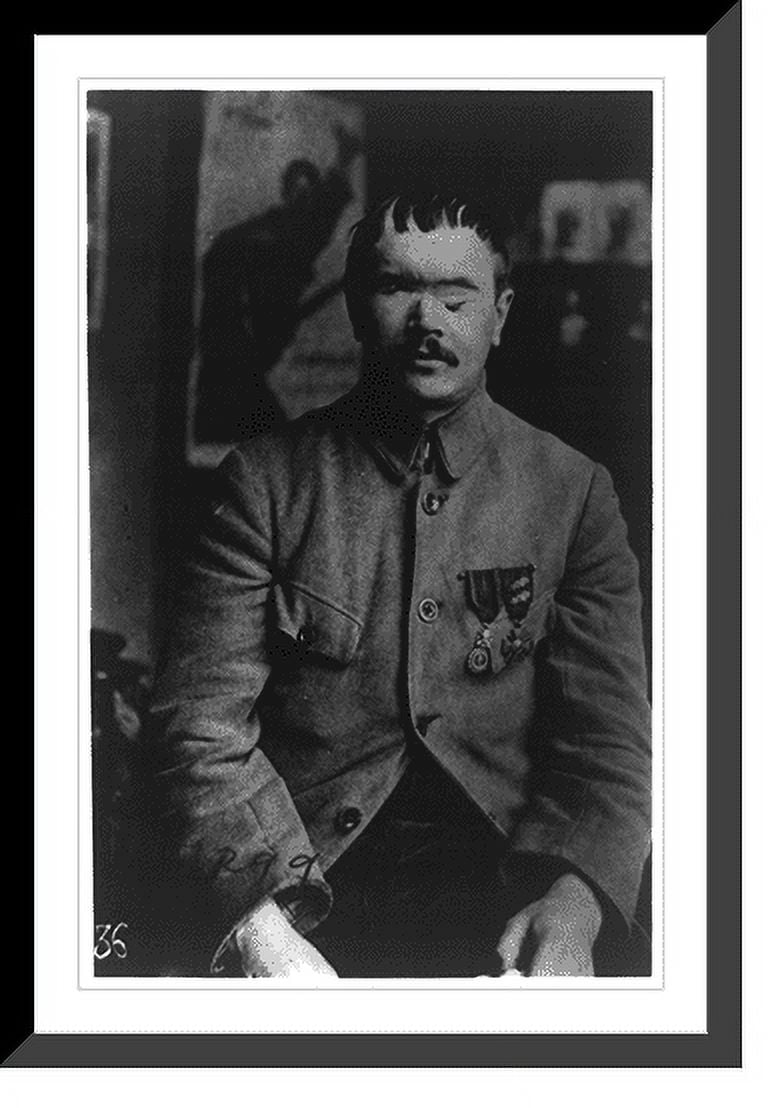 Historic Framed Print, French soldier, whose face was mutilated in the ...
