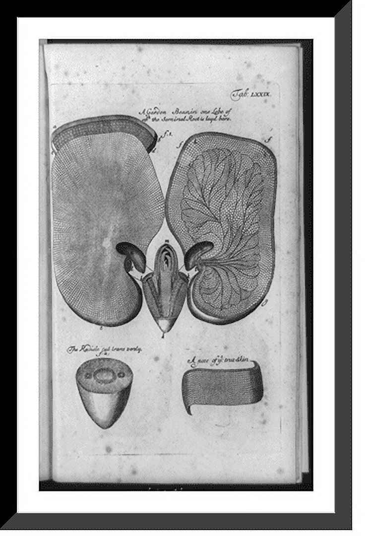 Historic Framed Print, A Garden bean in one lobe of wch. the seminal ...