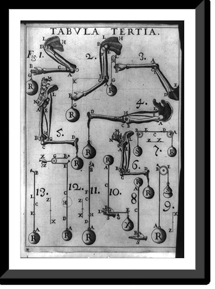 Historic Framed Print, [Movement of human appendages and pulley systems ...