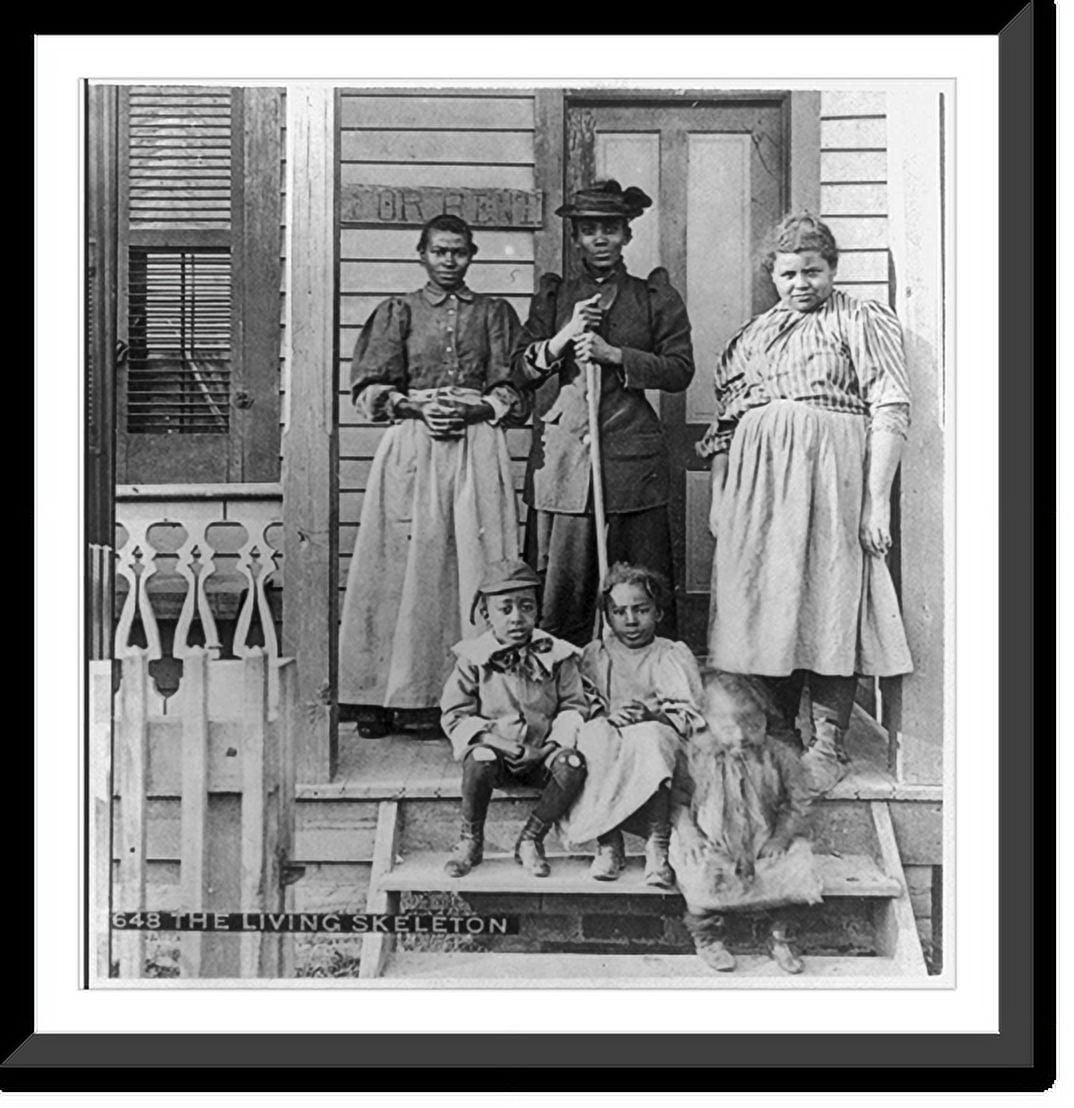 Historic Framed Print, The living skeleton, 17-7/8" x 21-7/8" - Walmart.com