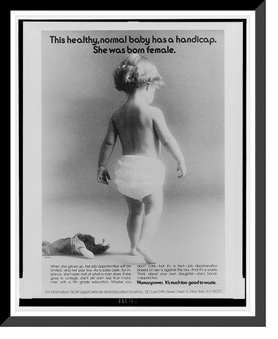 Historic Framed Print, This healthy, normal baby has a handicap : she ...