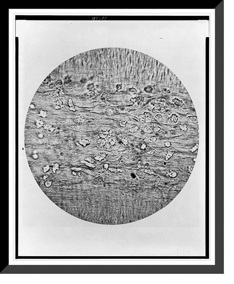 Historic Framed Print, White blood corpuscles, exhibiting amoeboid ...