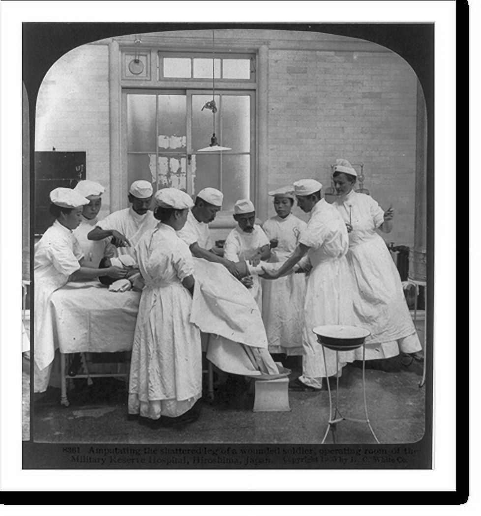 Historic Print, Amputating the shattered leg of a wounded soldier ...