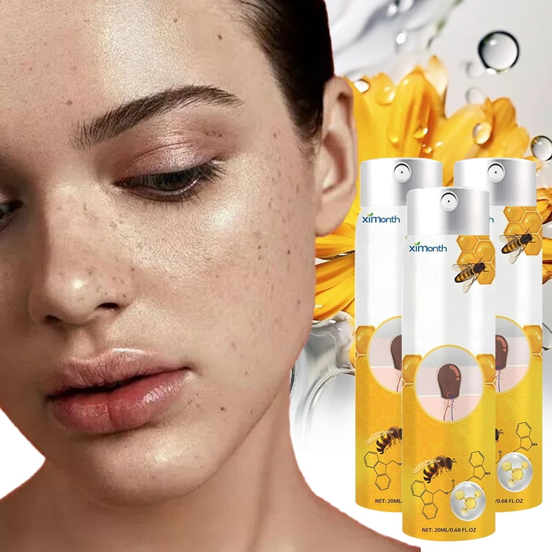 Honey Skin Care Spray, glycerin containing hypoallergenic moisturizer ...