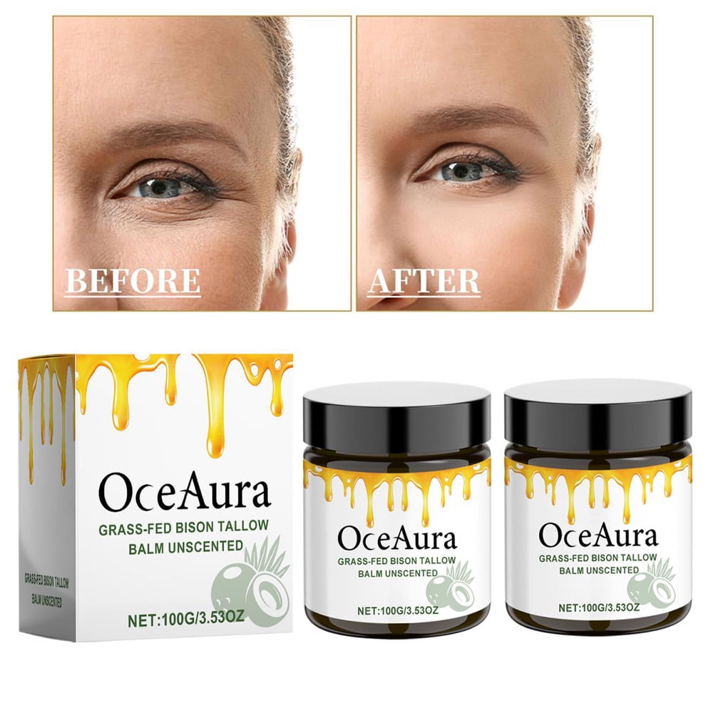 Honey Tallow Moisturizing Cream, Grass-fed Bison Tallow Balm, Face ...