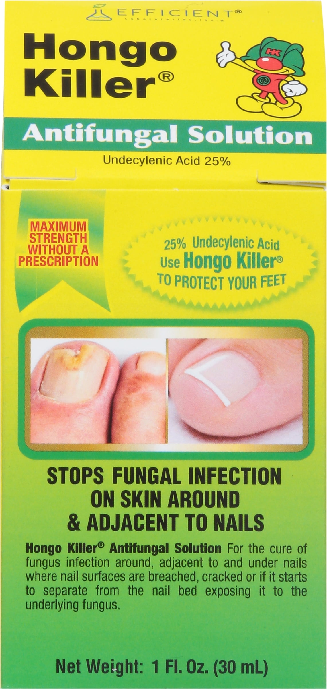 Hongo Killer Antifungal Solution, 1 oz - Walmart.com