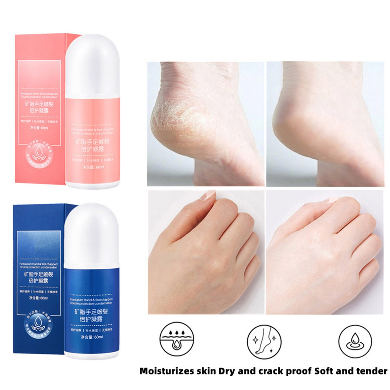 Hot Deals for Summer, Topliu Dry Skin Relief Cream, Chapped Foot ...
