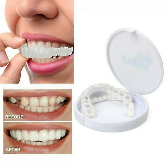 clip-on-veneers