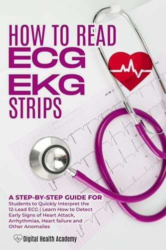 Pre-Owned How to Read EKG/ECG Strips: A Step-By-Step Guide for Students ...