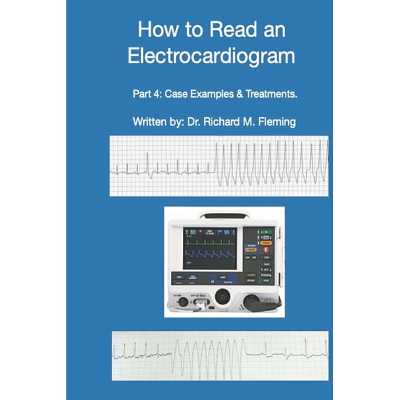 How to Read an Electrocardiogram.: How to Read an Electrocardiogram ...