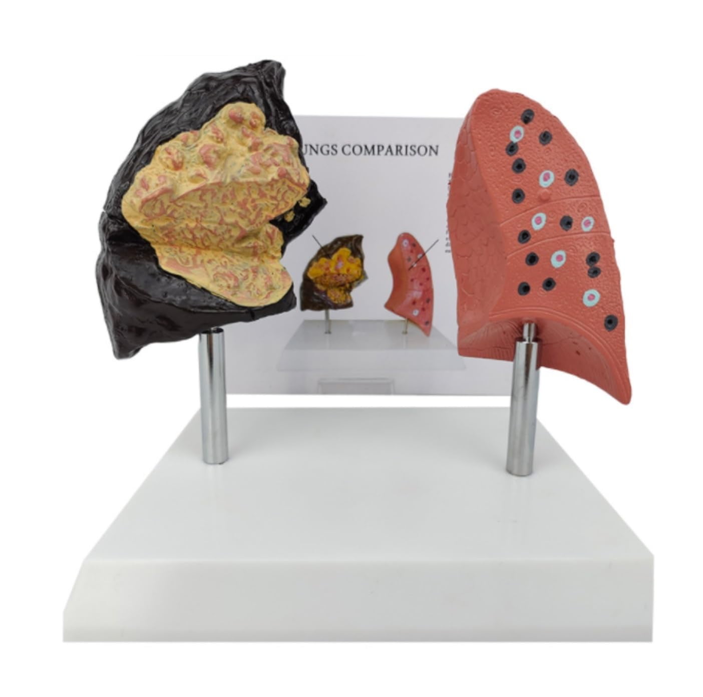 Human Anatomy Model Human Lung Model Smoking Lung And Normal Lung ...
