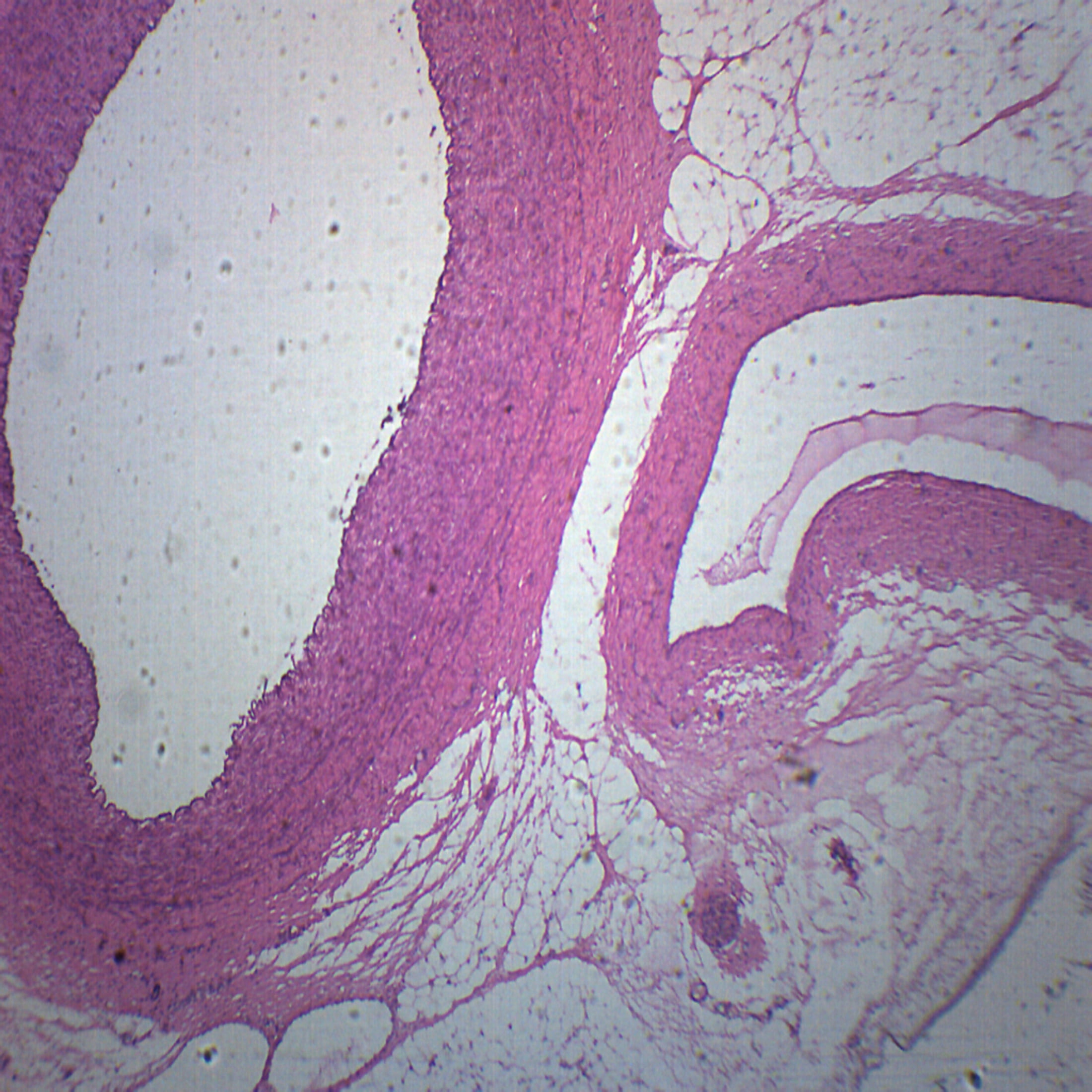 Human Artery, Vein & Nerve - Cross Section - Prepared Microscope Slide ...