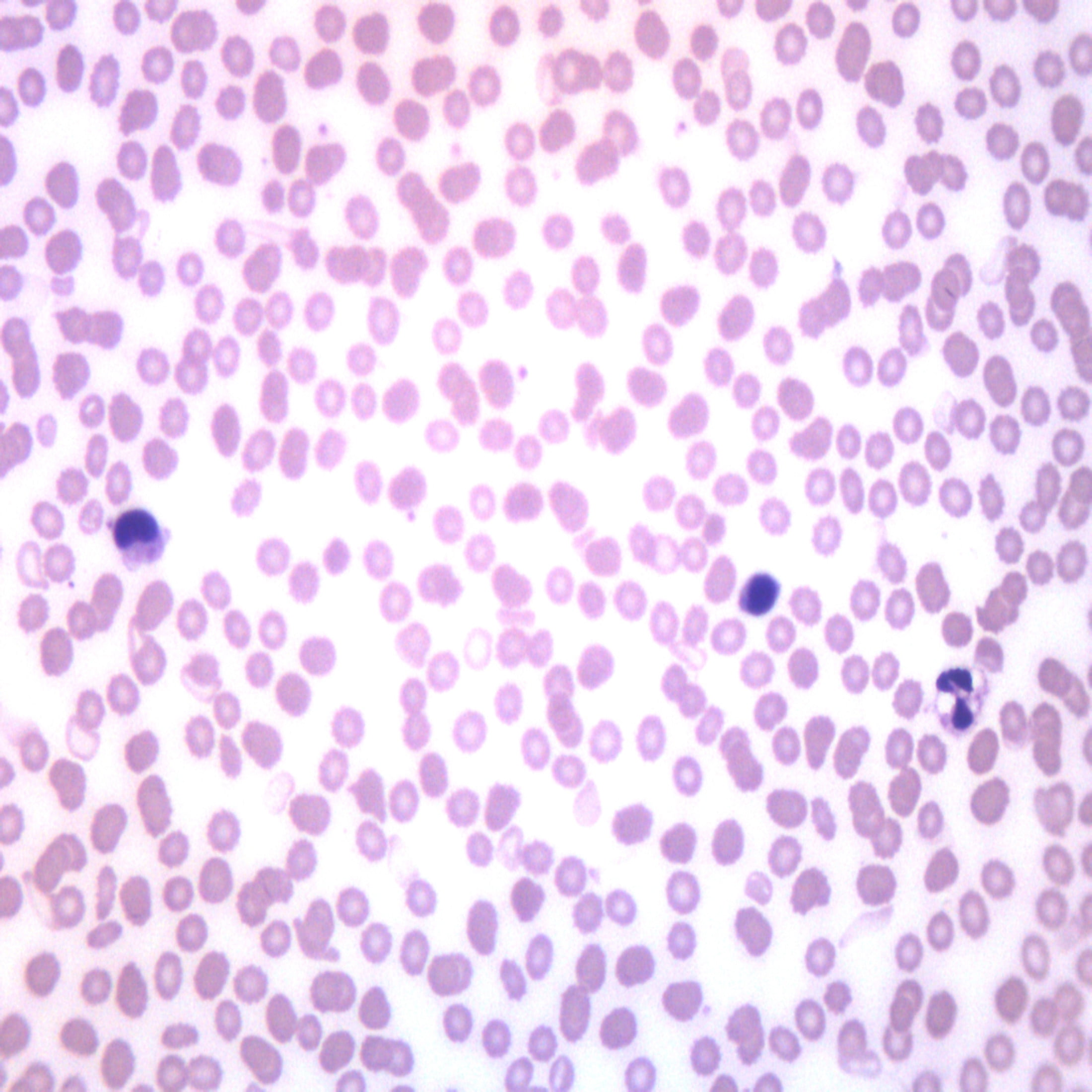 Human Blood Smear WR Stain, Prepared Microscope Slide - 75 x 25mm ...