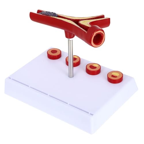 Human Blood Vessel Model Vascular Model PVC Tool Human Body Human ...