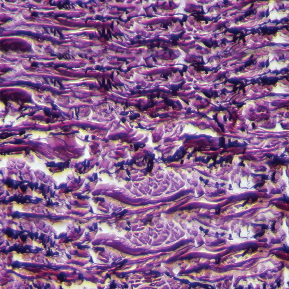Human Elastic Tissue Slide, Sec., 7 M, Verhoeff's Stain - Walmart.com