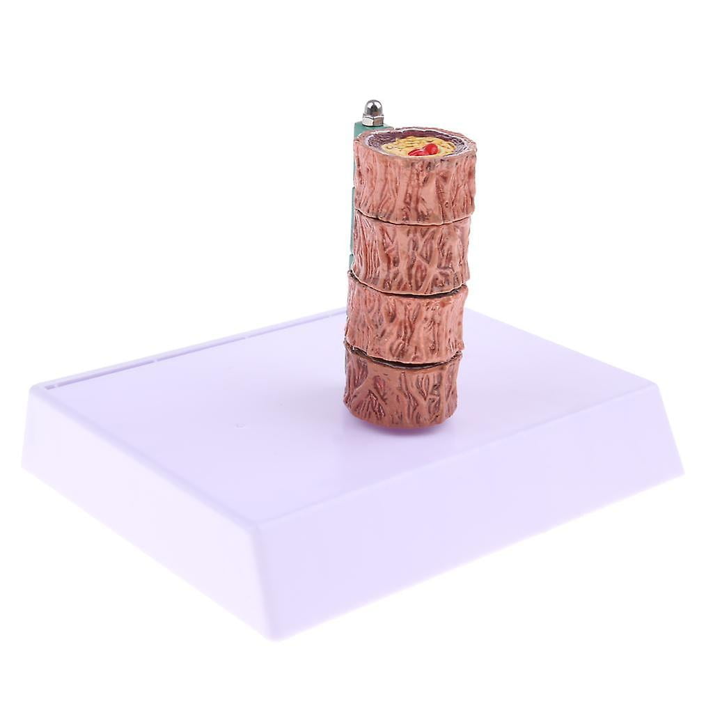 Human Enlarged 4-piece Artery Vessel Atherosclerosis Thrombosis Model ...