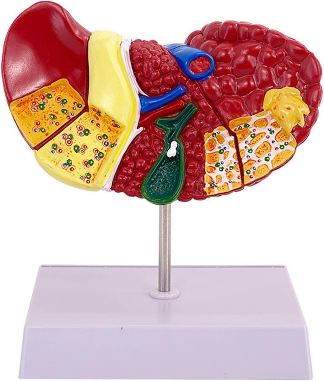 Human Liver Model, Anatomical Pathology Liver Model, with Base and ...