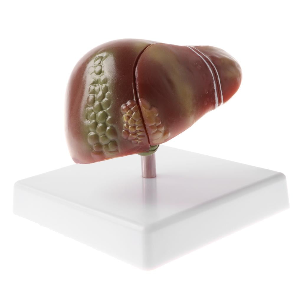 Human Liver Model, Shown Lobule, Cyst, And Biliary System, & Model, Lab ...