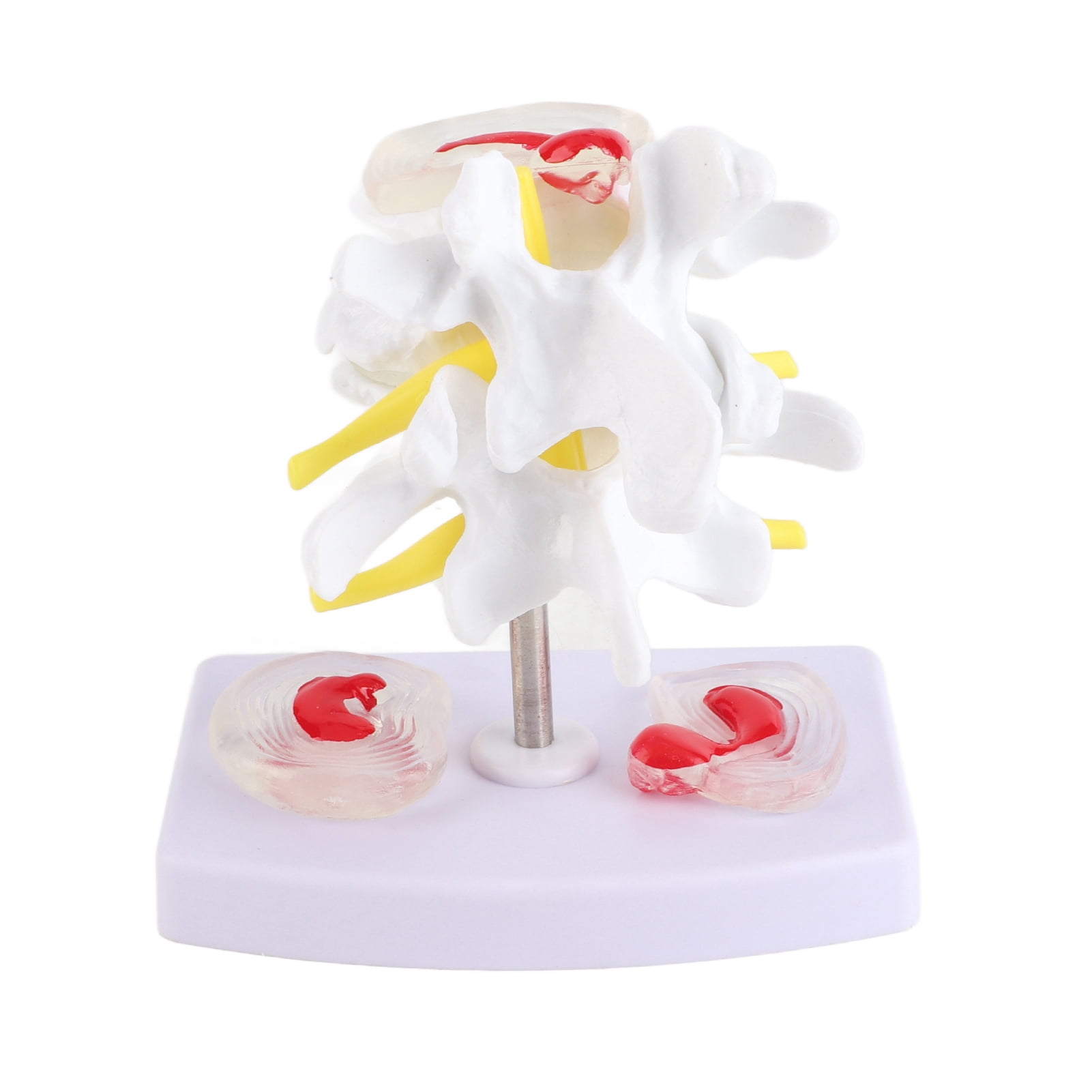 Human Lumbar Spine Model, Anatomy For Study Classroom Use, 96 ...