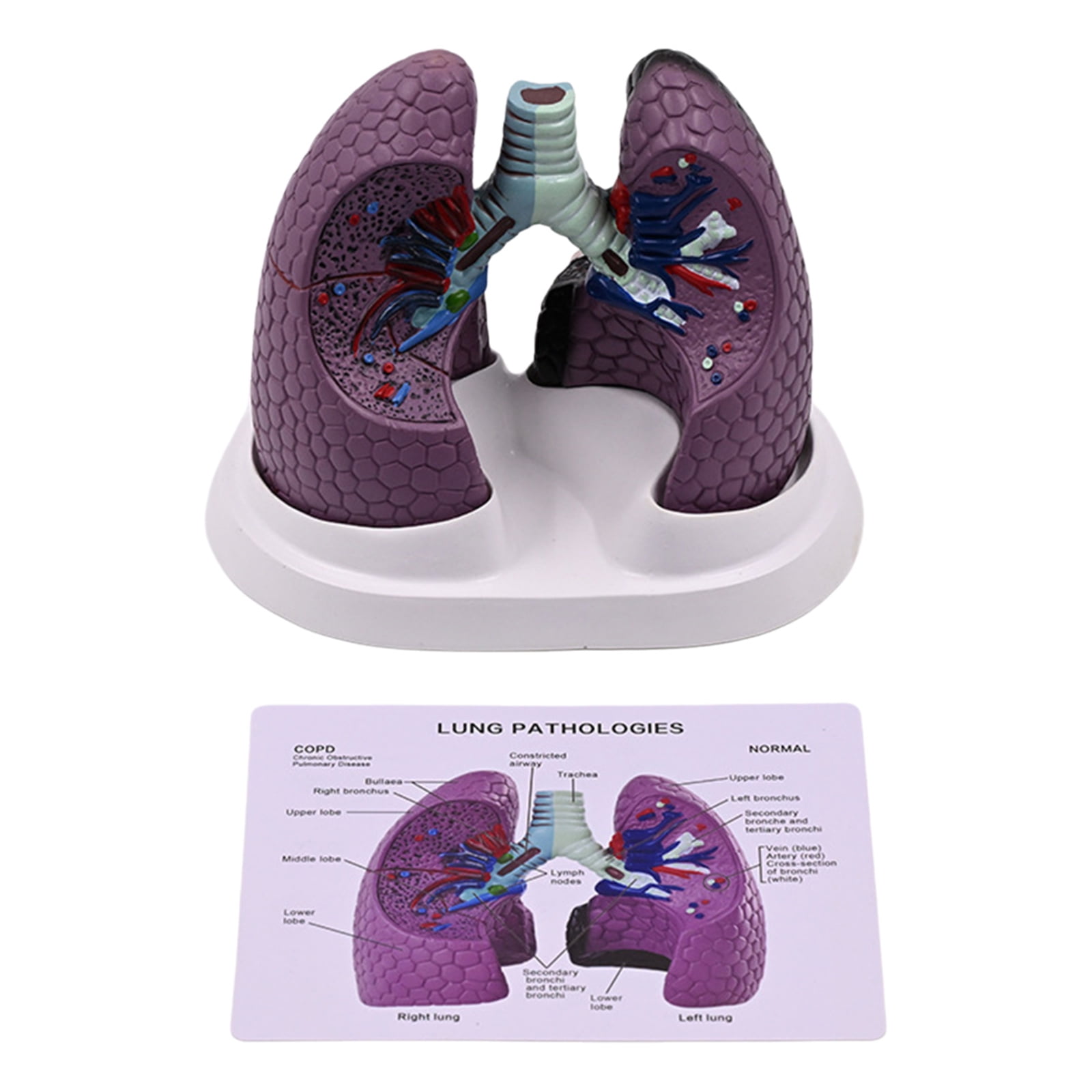 Human Lung Anatomy Model Anatomical Pathological Lung Model Realistic ...