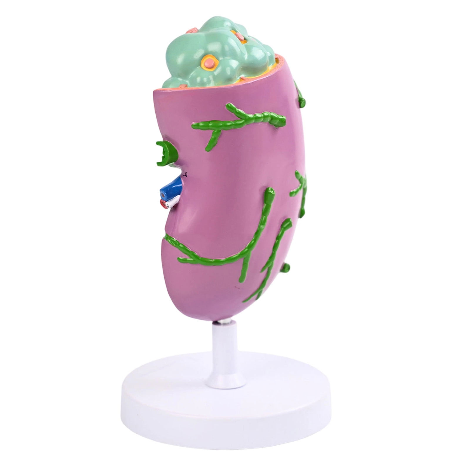 Human Lymph Node Anatomy Model Anatomical PVC Lymphatic Structure Model ...