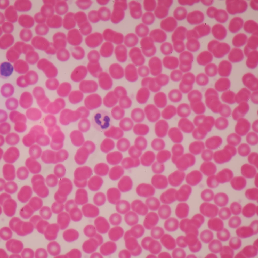 Carolina Biological Supply Company Microscope Prepared Slides, Glass ...