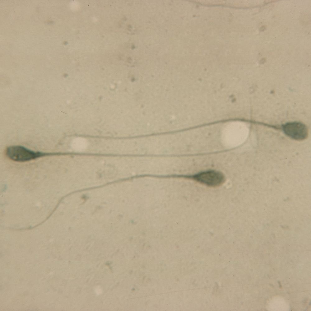 Human Microcope Slide, Smear - Walmart.com
