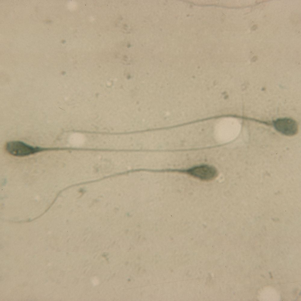 Human Sperm Prepared Microcope Slide, Smear - Walmart.com