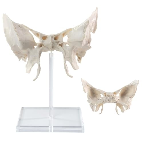 Human Sphenoid Anatomical Model, Life Size, Presenting Complete Cracks ...