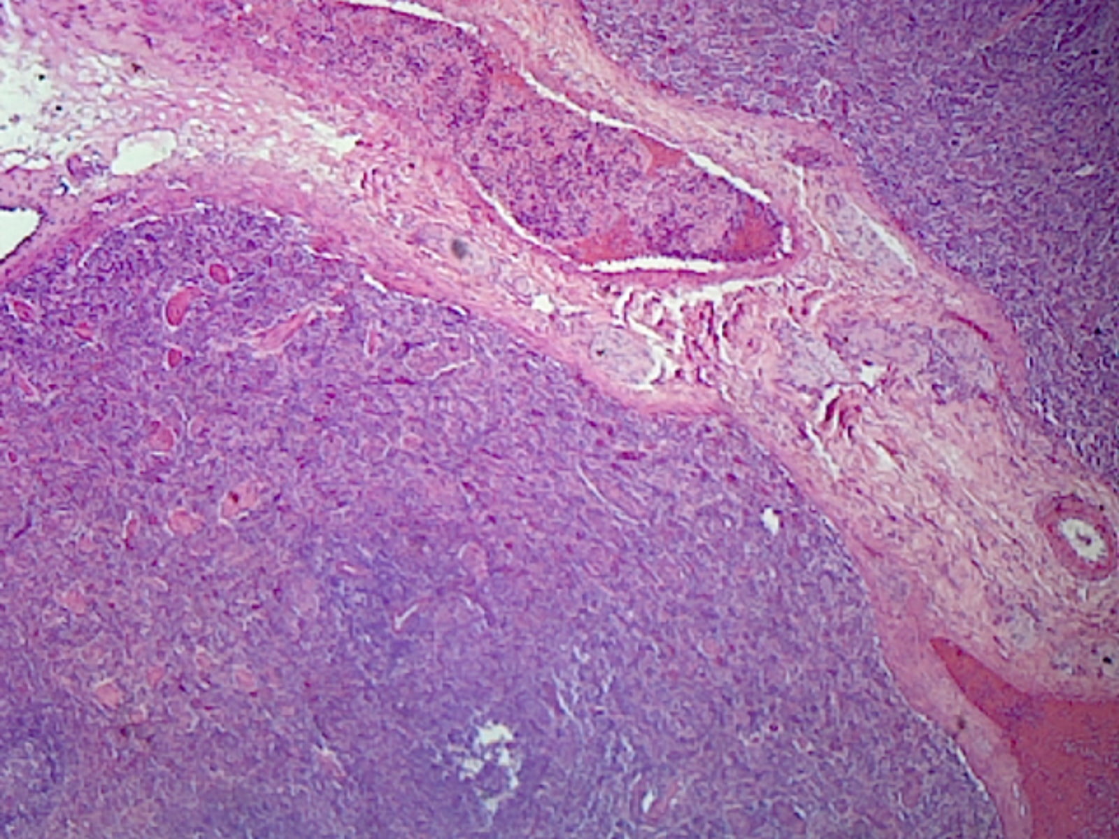 Human Spleen; Section; H&E Stain by Go Science Crazy - Walmart.com