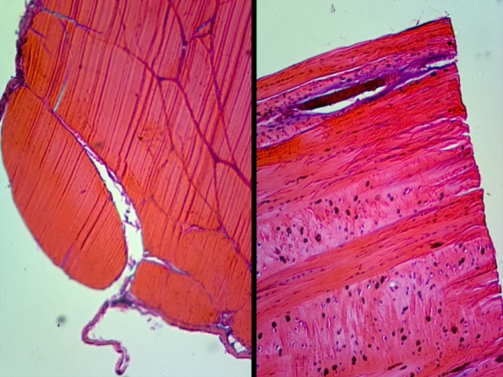 Human Tendon Composite; Cross Section and Longitudinal Section by Go ...