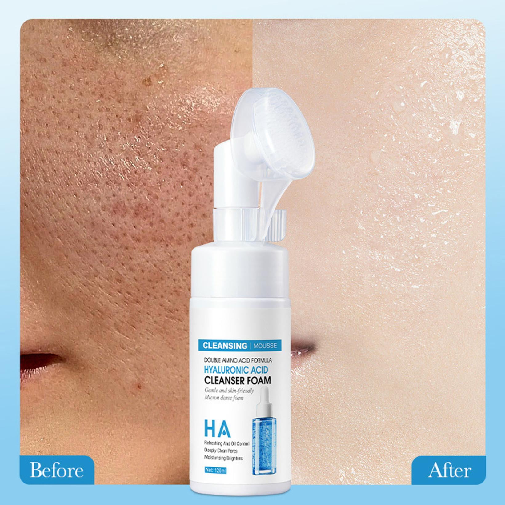 Hyaluronic Amino Cleansing Foam Cleanser, Face Wash for Oily Skin ...