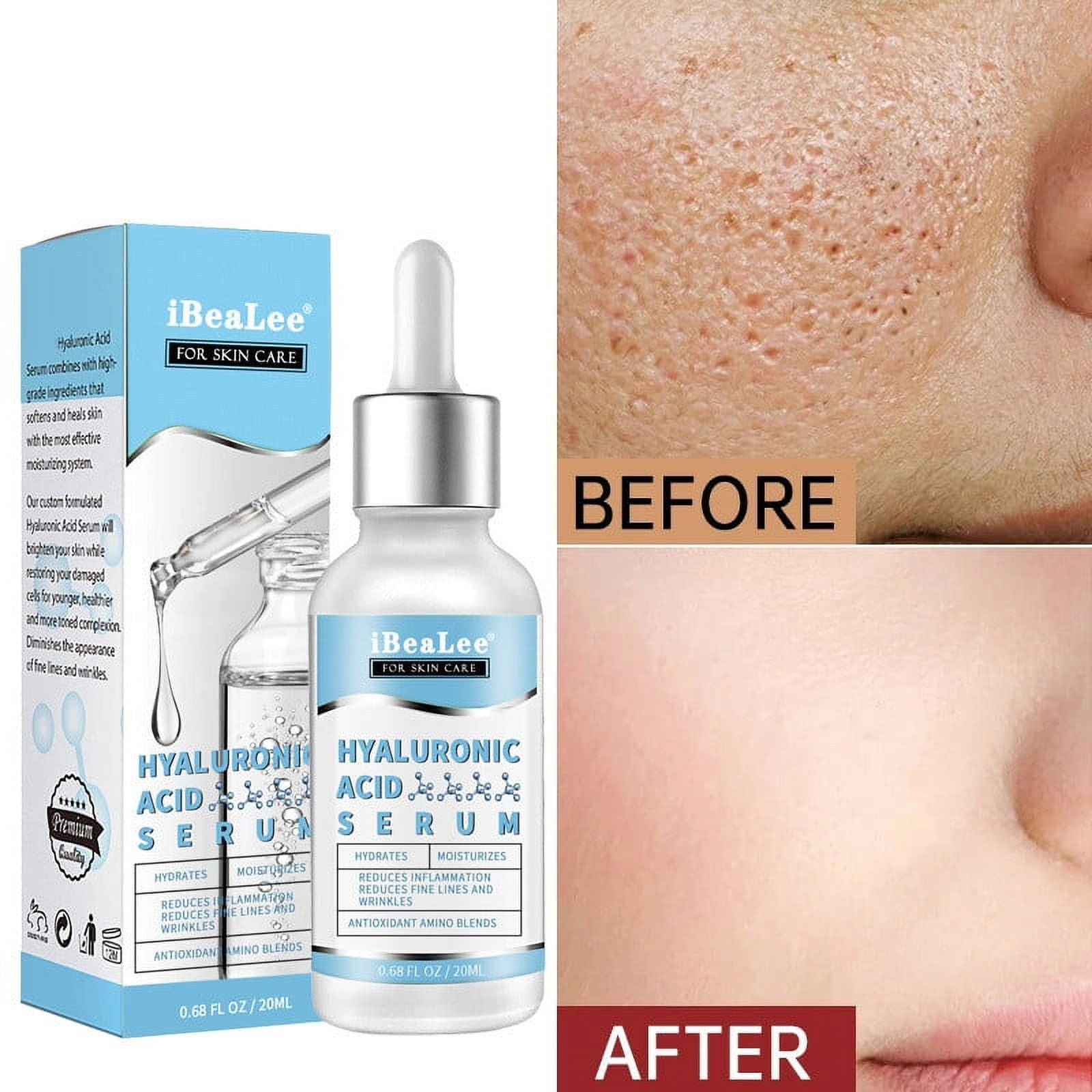 Hyaluronic Essence Solution Anti-wrinkle Facial Moisturizing ...
