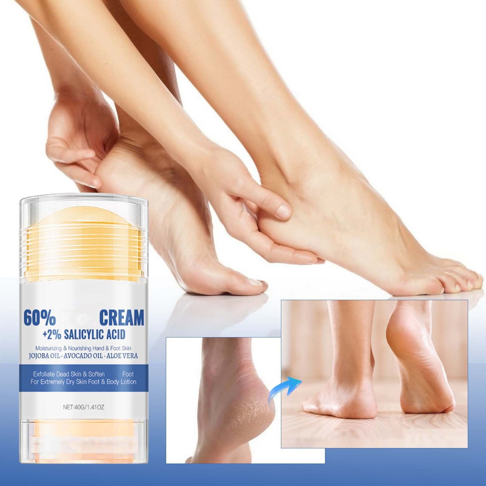 Hydrating Foot Cream for Peeling SkinMoisturizes & Nourishes Dry Feet ...