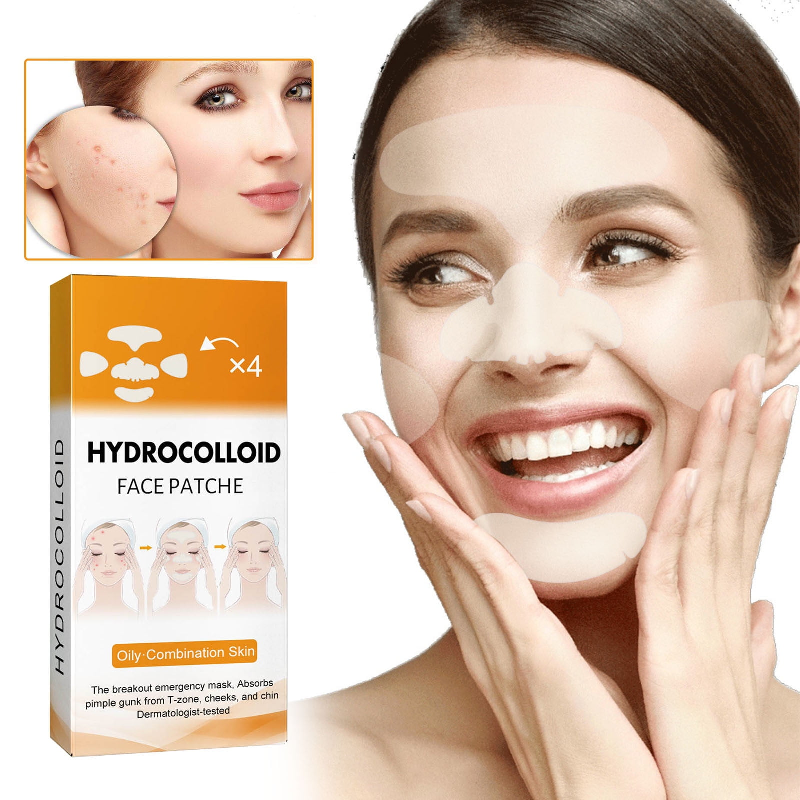 Hydrogel Facial Patches - Portable, Transparent - Absorb Pus, Conceal ...