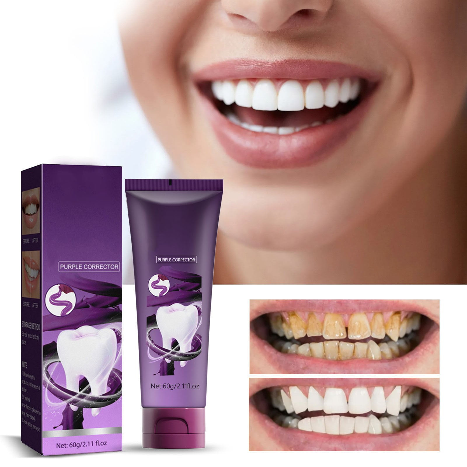 Hydroxyapatite Toothpaste Whitening Teeth Cleaning Oral Cavity ...