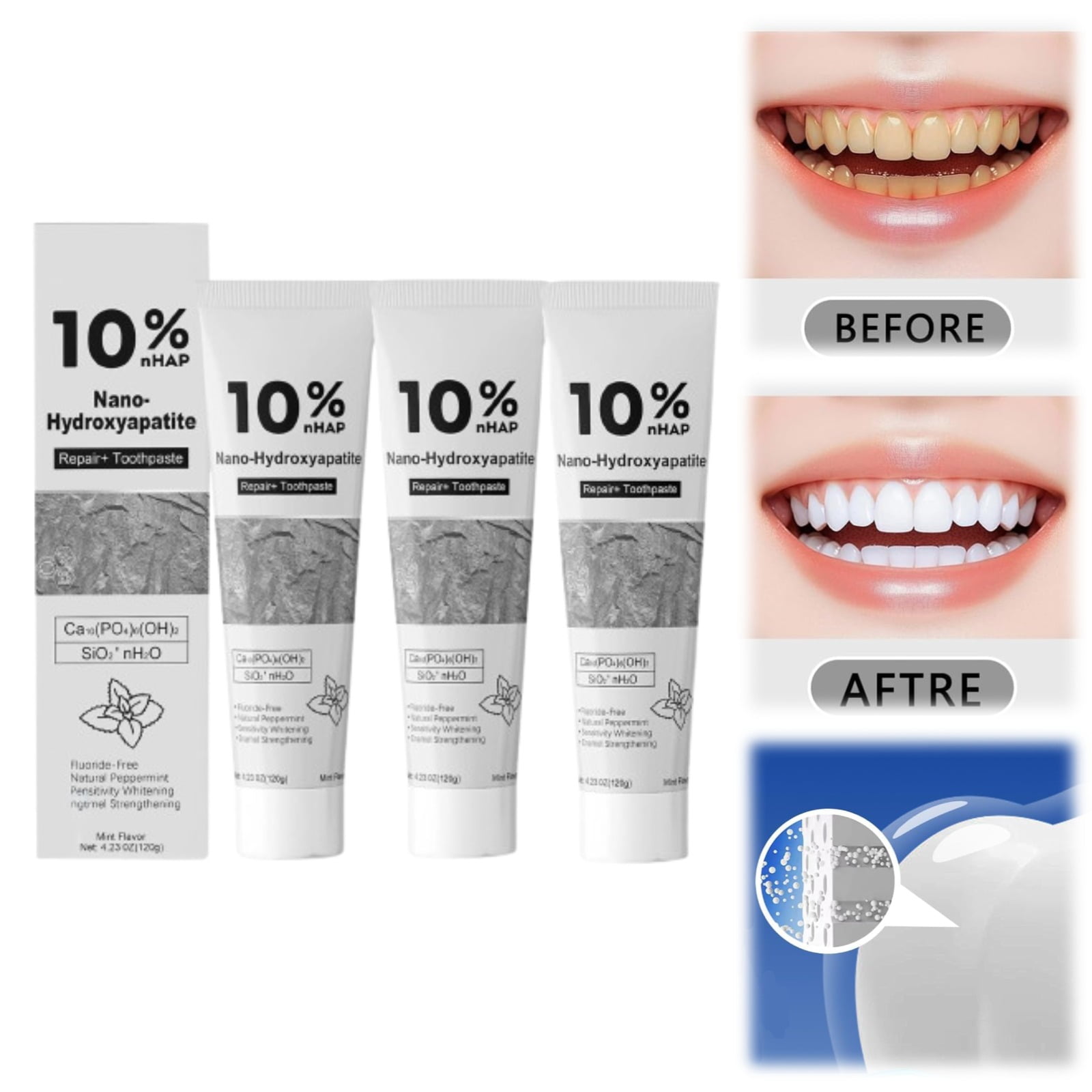 Hydroxyapatite Toothpastes for Enamel Protection and Tooth ...