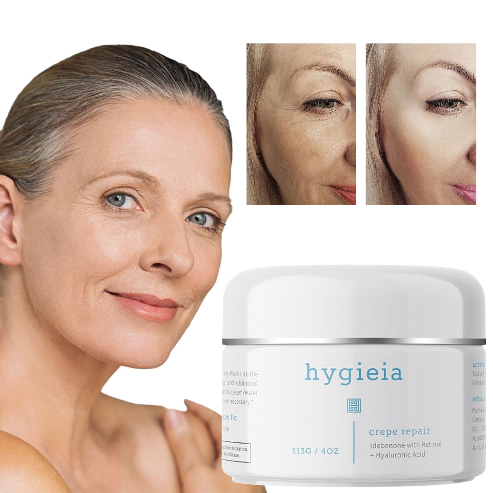 Hygieia Crepe Repair Cream Skin Repair Cream Liposomal For Arms Skin ...