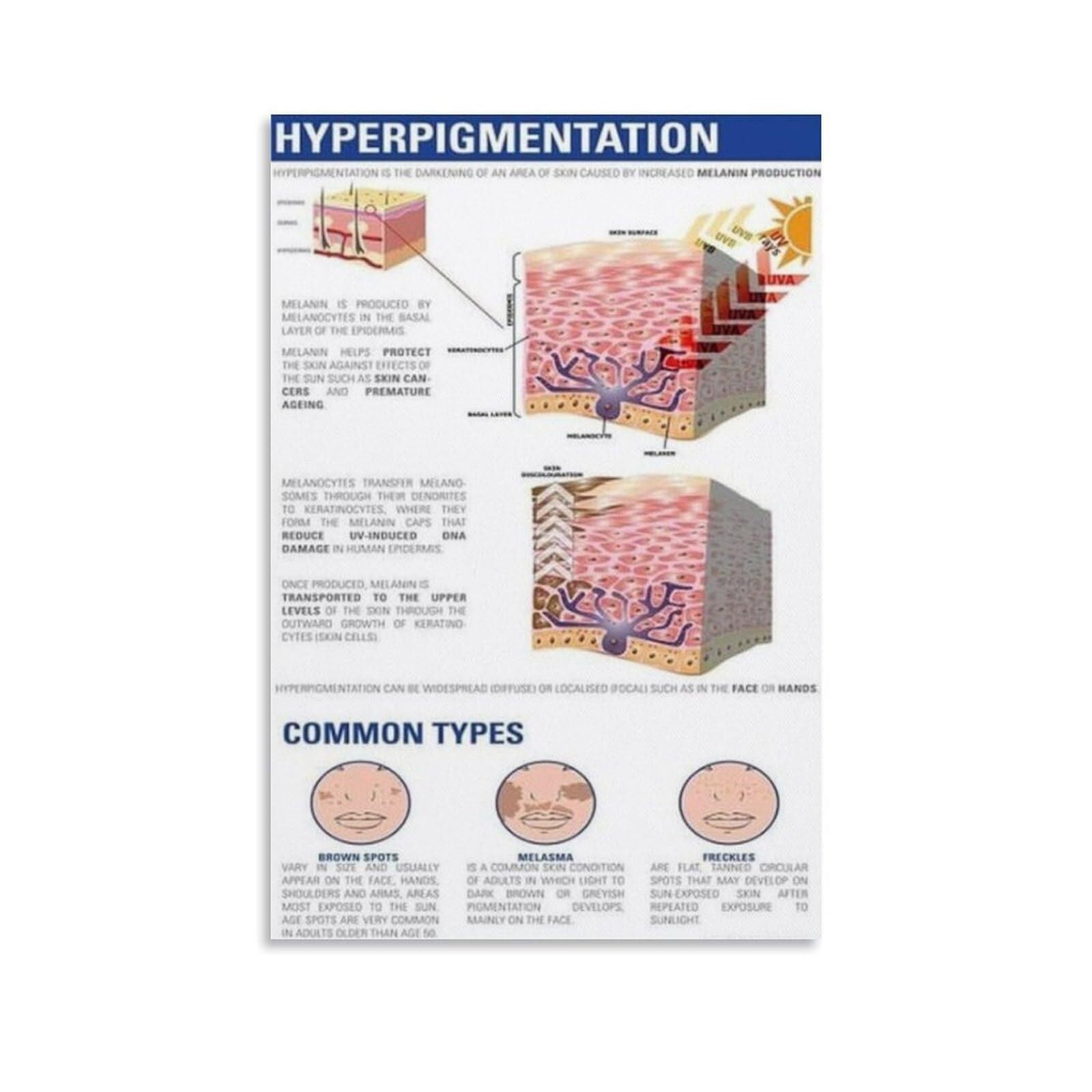 Hyperpigmentation Art Skin Care Tips Spa Poster Canvas Print Aesthetic ...