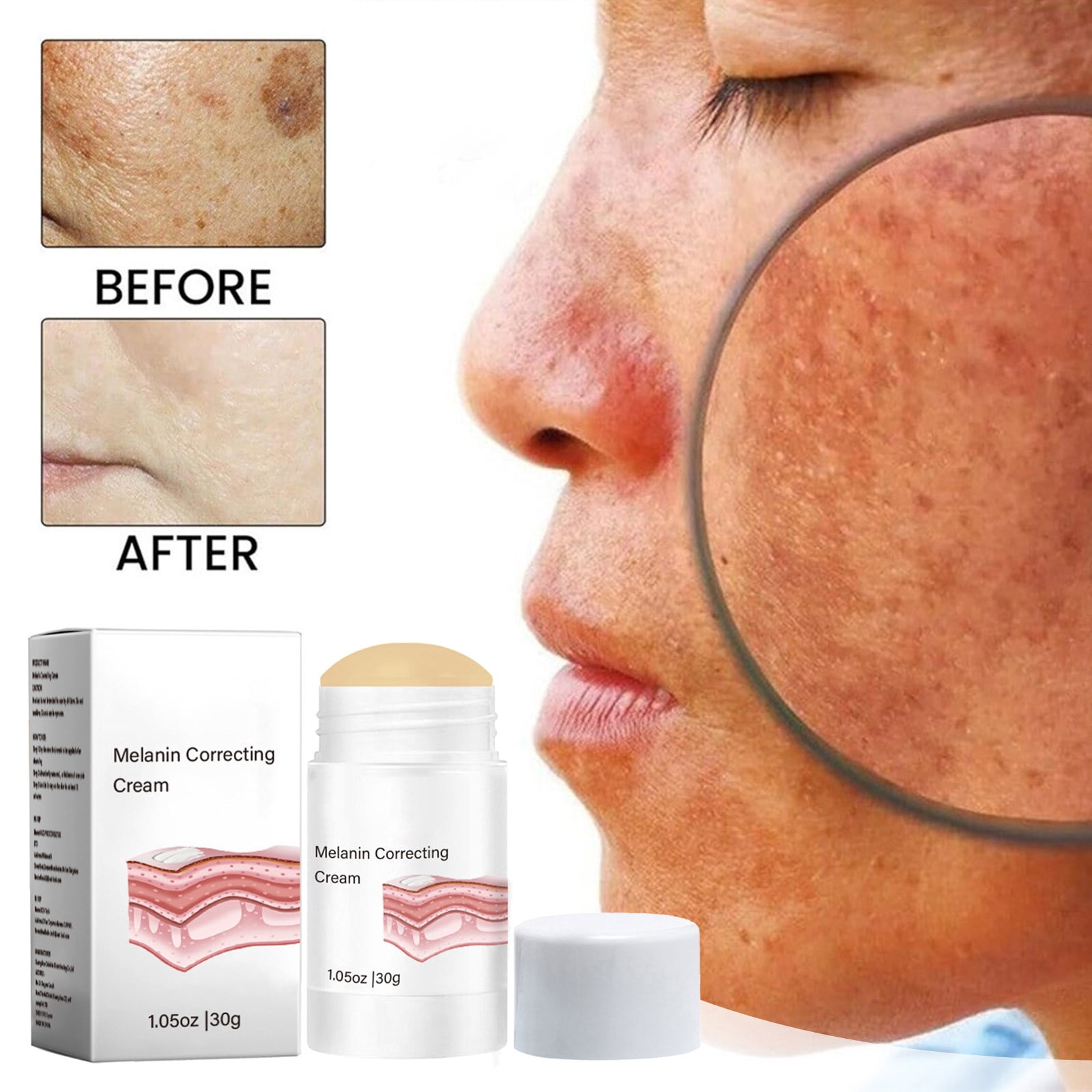 Hypoallergenic Exfoliating Skin Care Melanin Correcting Dark Corrector ... Hypoallergenic Exfoliating Skin Care Melanin Correcting Dark Corrector ...