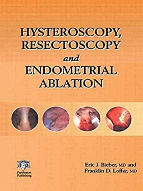 Pre-Owned Hysteroscopy, Resectoscopy and Endometrial Ablation ...